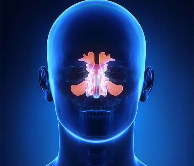 Balloon Sinus Dilation St Louis MO - Sinus Relief Festus MO